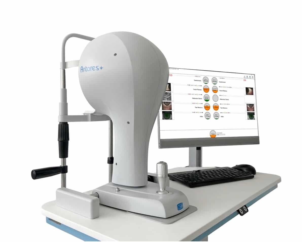Efficacité clinique du Topographe cornéen amélioré combiné à l'analyse ...