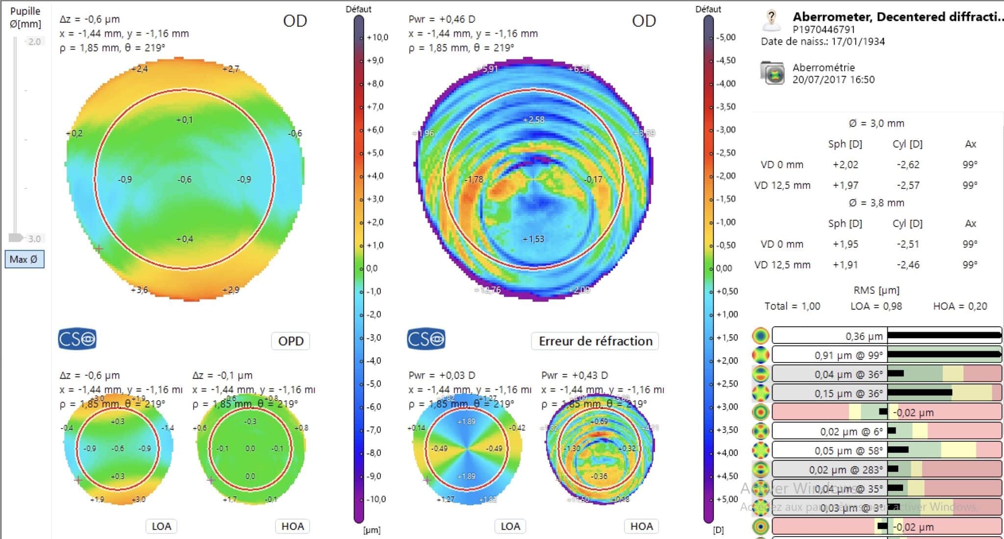 👉 "Osiris ", un aberromètre utilisant la technologie d’analyse ...