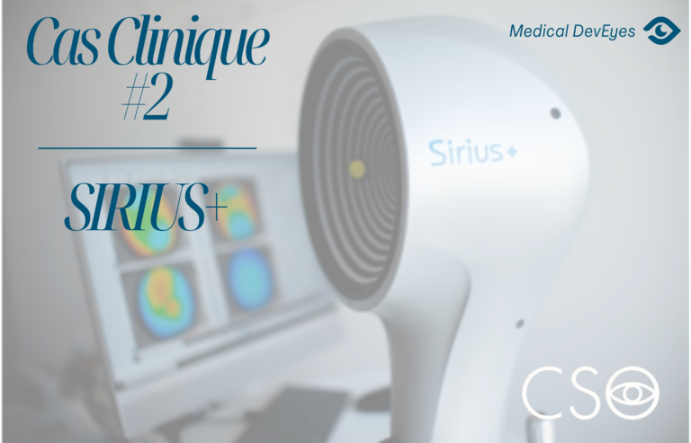 🔹 Topographe Sirius + | Cas clinique #2 – Kératocône - Medical Deveyes